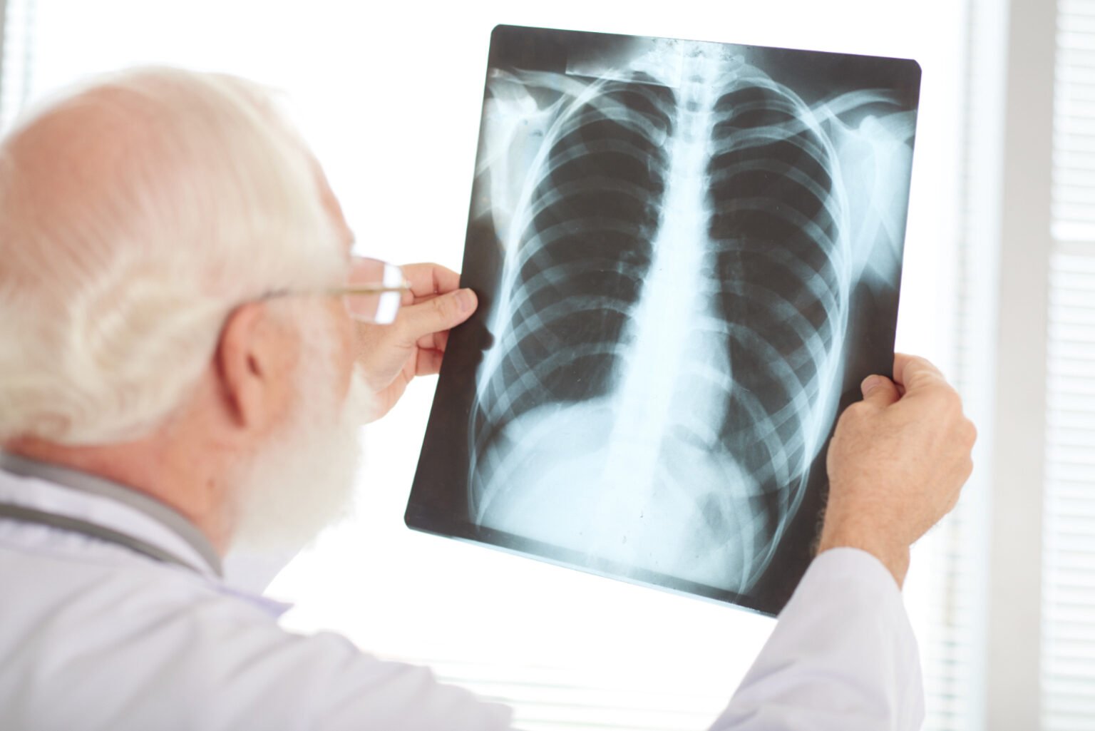 Tuberculosis Comprehensive Guide - Illnesses & Conditions Tuberculosis Comprehensive Guide - Illnesses & Conditions